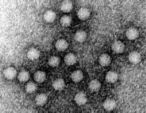 Parvovirus B19 – rheuma-online