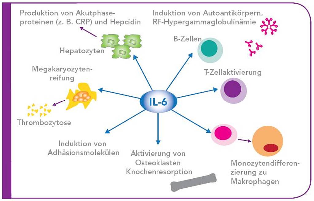 Interleukin-6 (IL-6) – rheuma-online