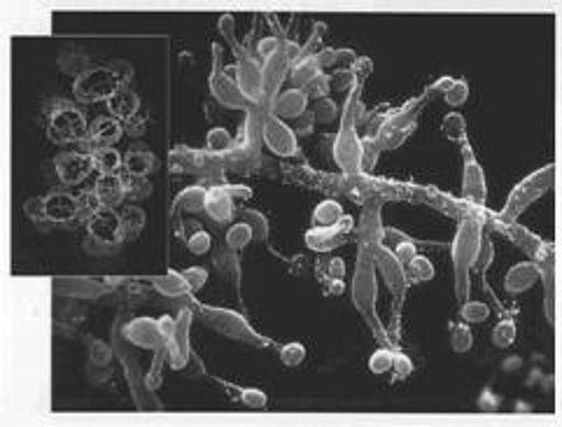 Ciclosporin (Cyclosporin A): Die Geschichte seiner Entdeckung und die ...